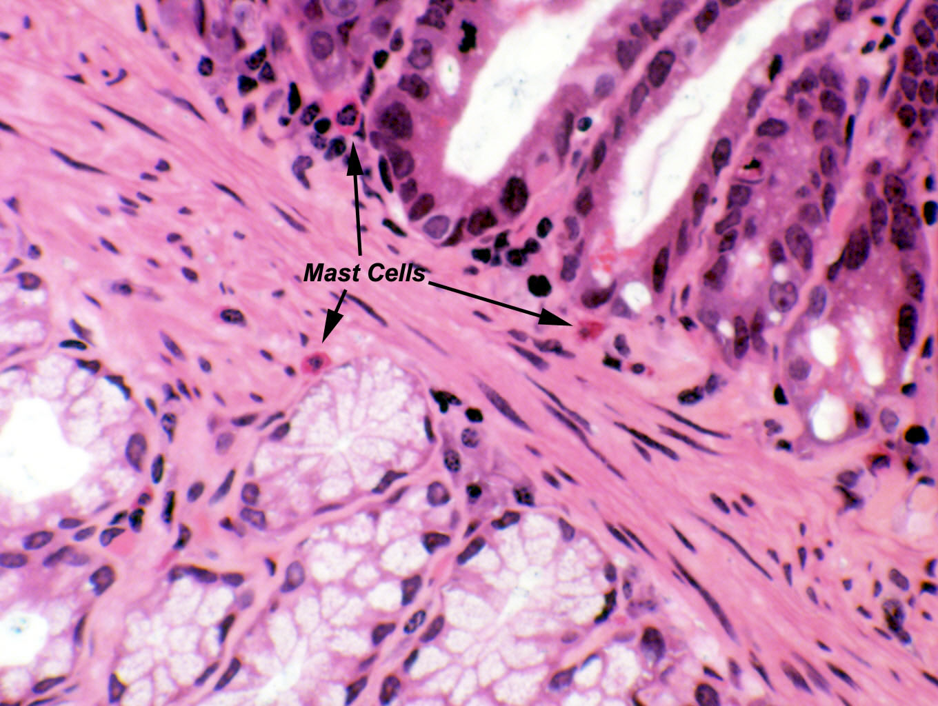 Mast Cells Histology
